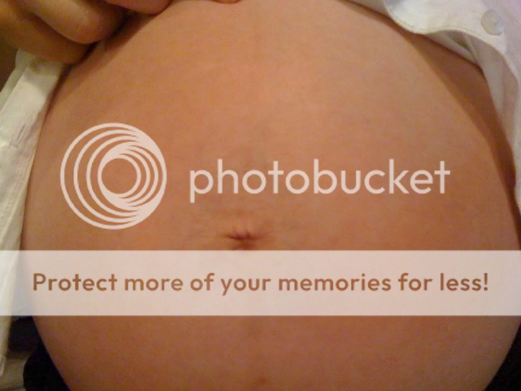 Blue Circle Around Belly Button GIANT Pic Added JustMommies blue-circle-around-belly-button-giant-pic-added-justmommies